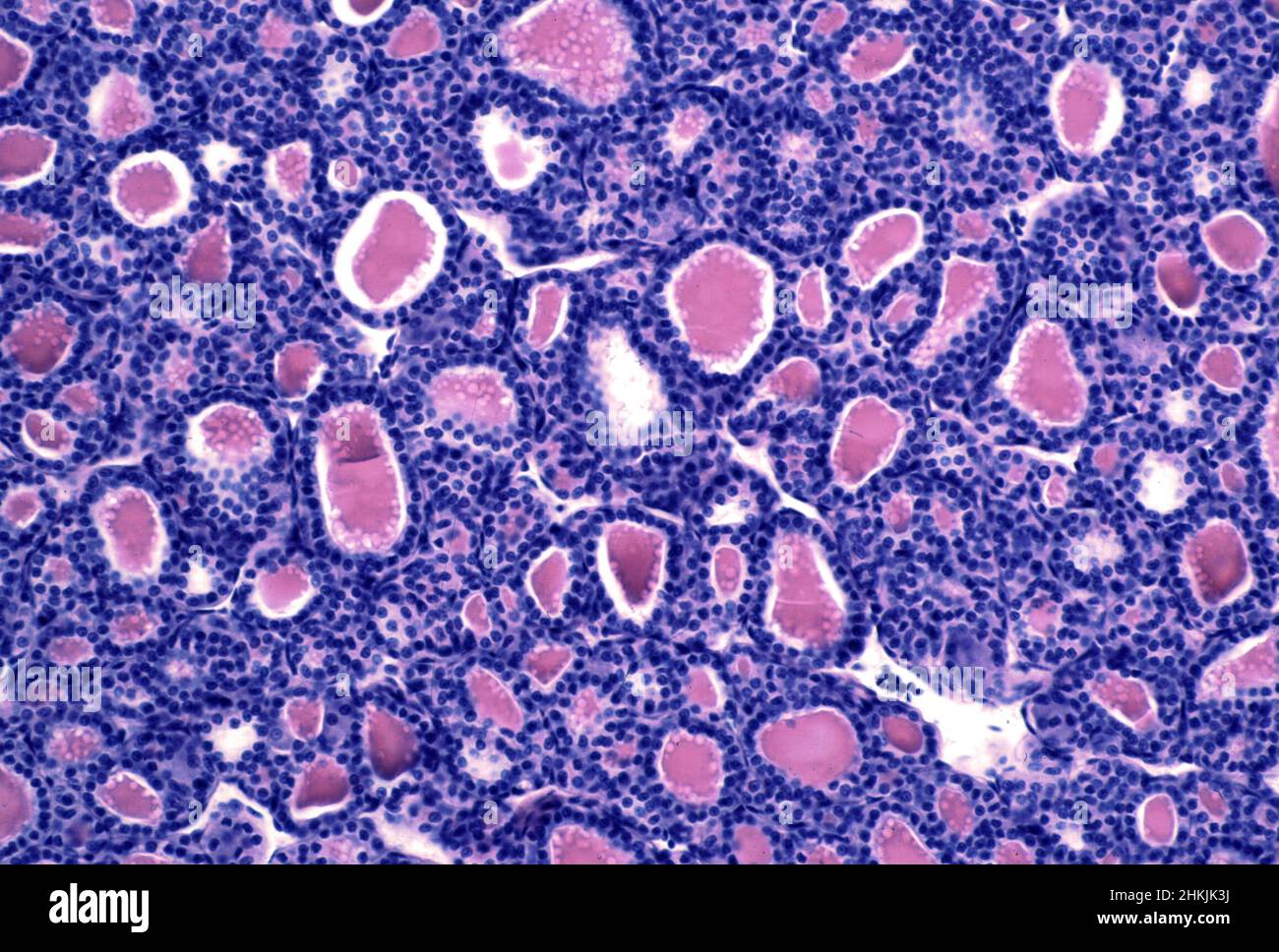Cat thyroid gland, light micrograph Stock Photo - Alamy