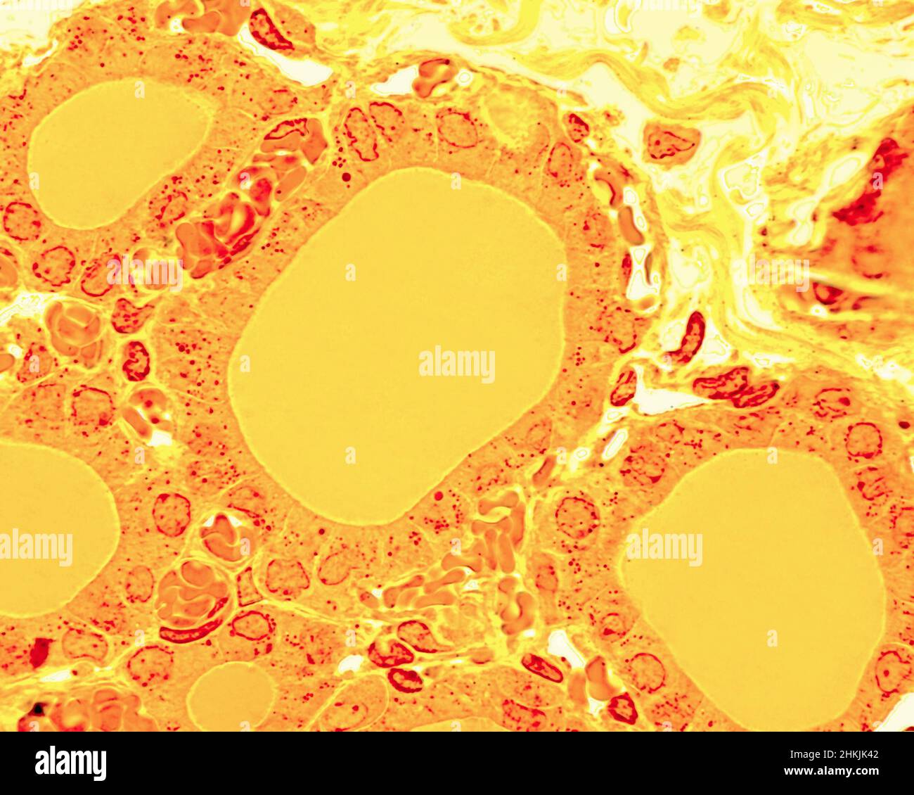 Thyroid gland follicles, light micrograph Stock Photo - Alamy