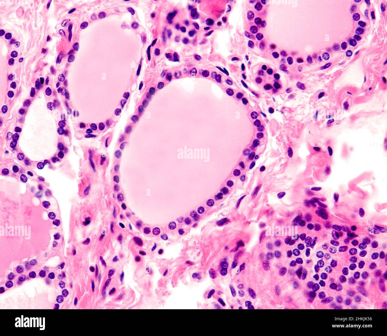 Human thyroid gland, light micrograph Stock Photo - Alamy