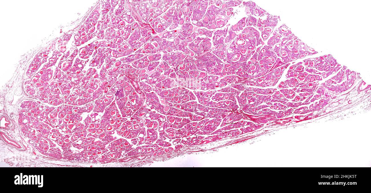 Human thyroid gland, light micrograph Stock Photo - Alamy