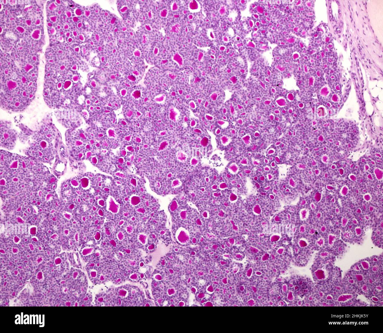 Cat thyroid gland, light micrograph Stock Photo - Alamy