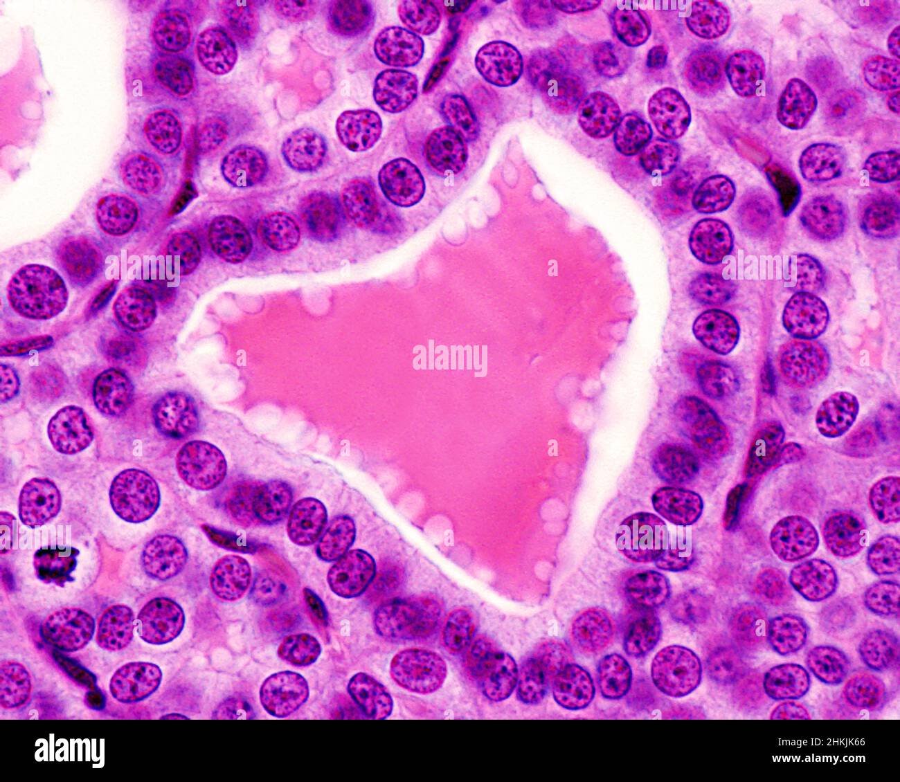Thyroid gland follicle, light micrograph Stock Photo - Alamy
