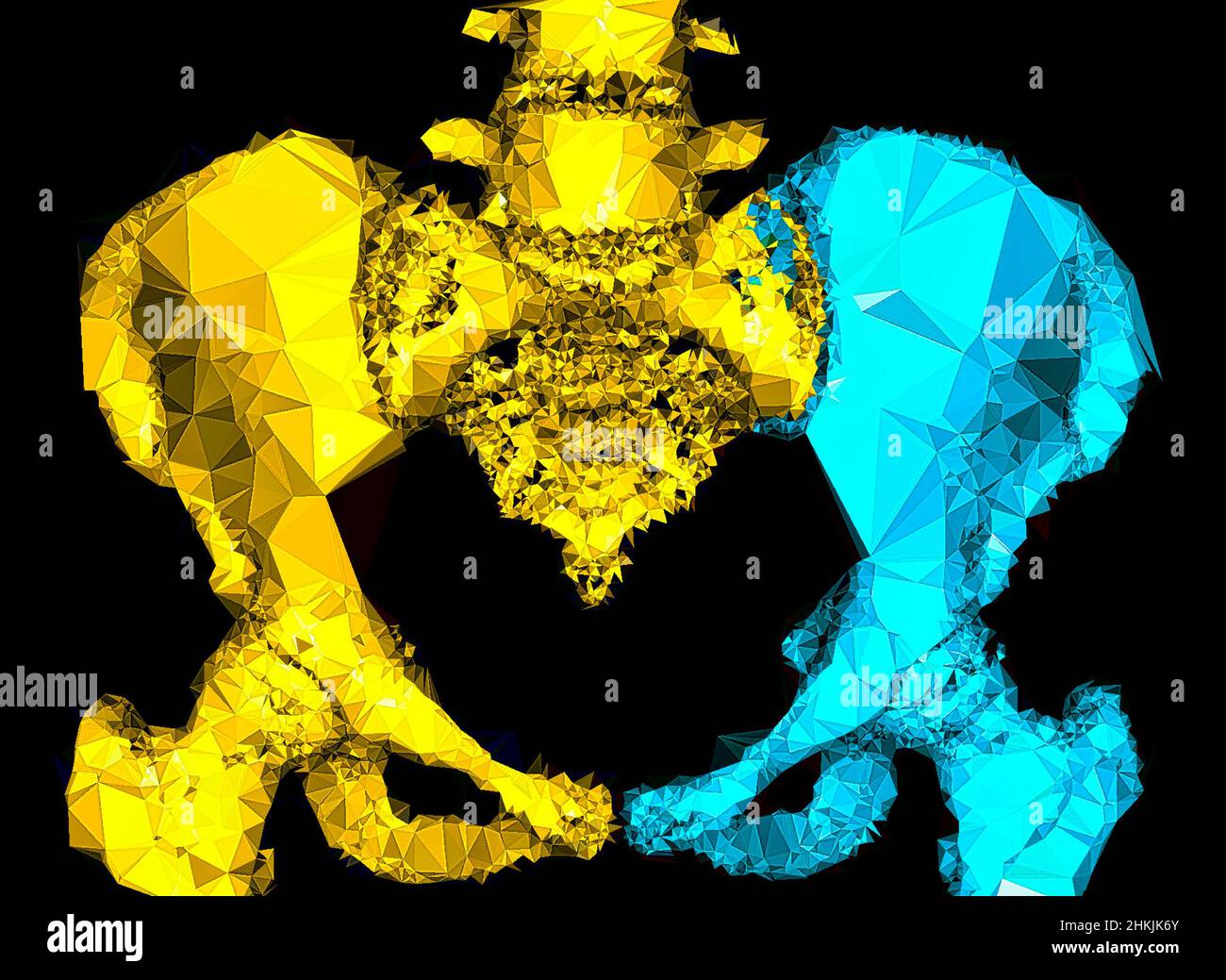 Pelvis, CT scan Stock Photo - Alamy