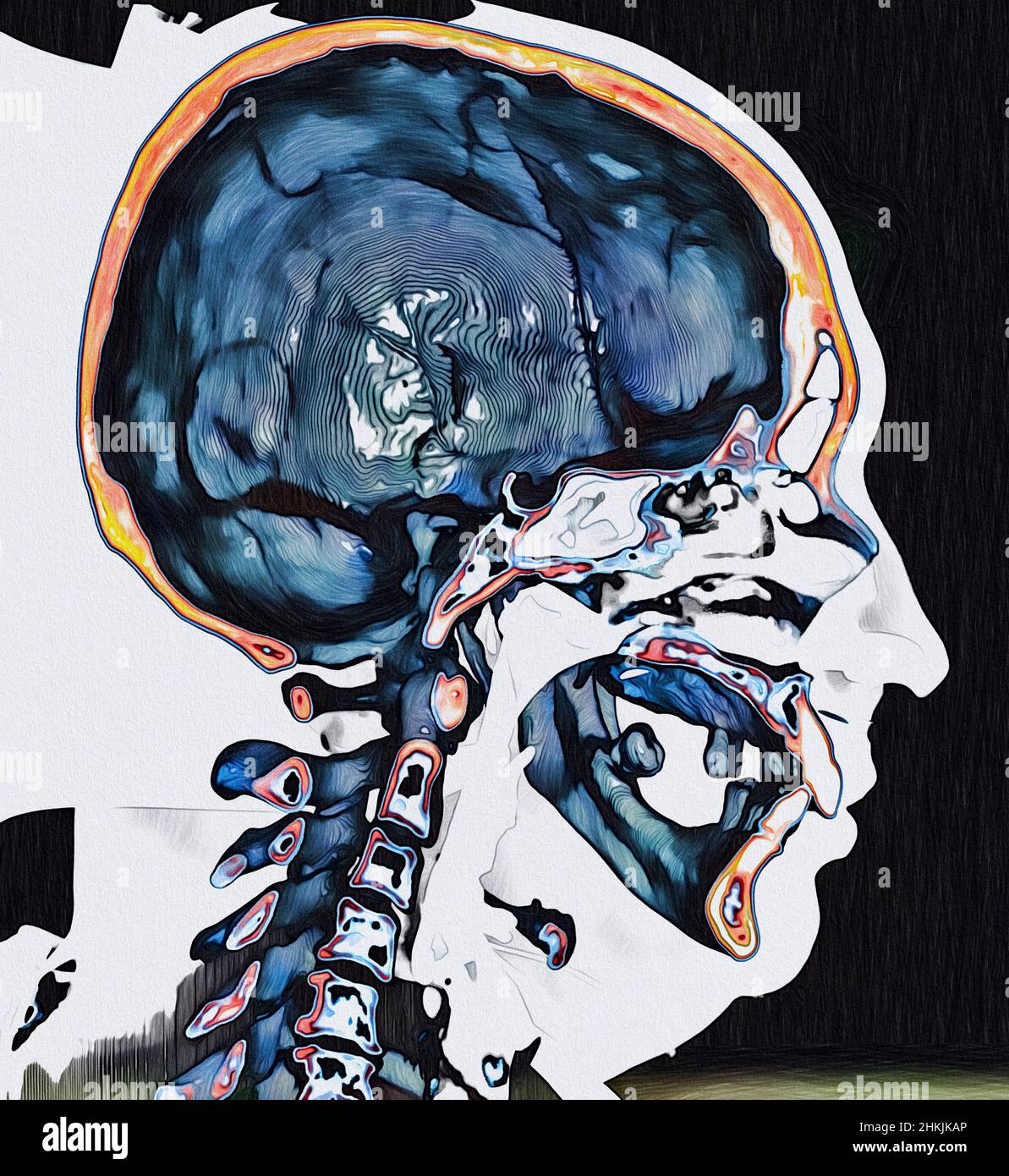 Bones of the skull and neck, CT scan Stock Photo - Alamy