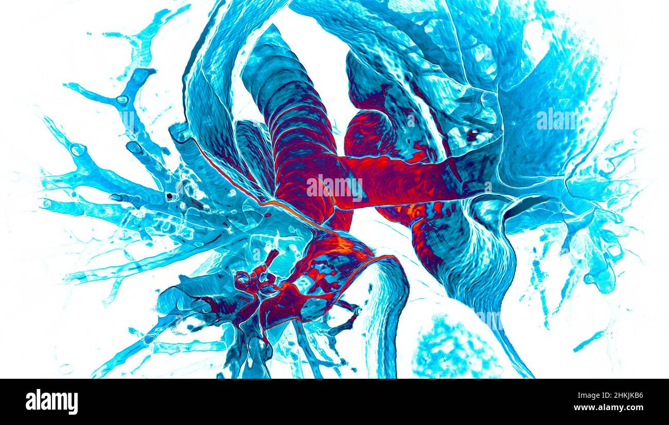 Healthy lungs, 3D CT scan Stock Photo - Alamy