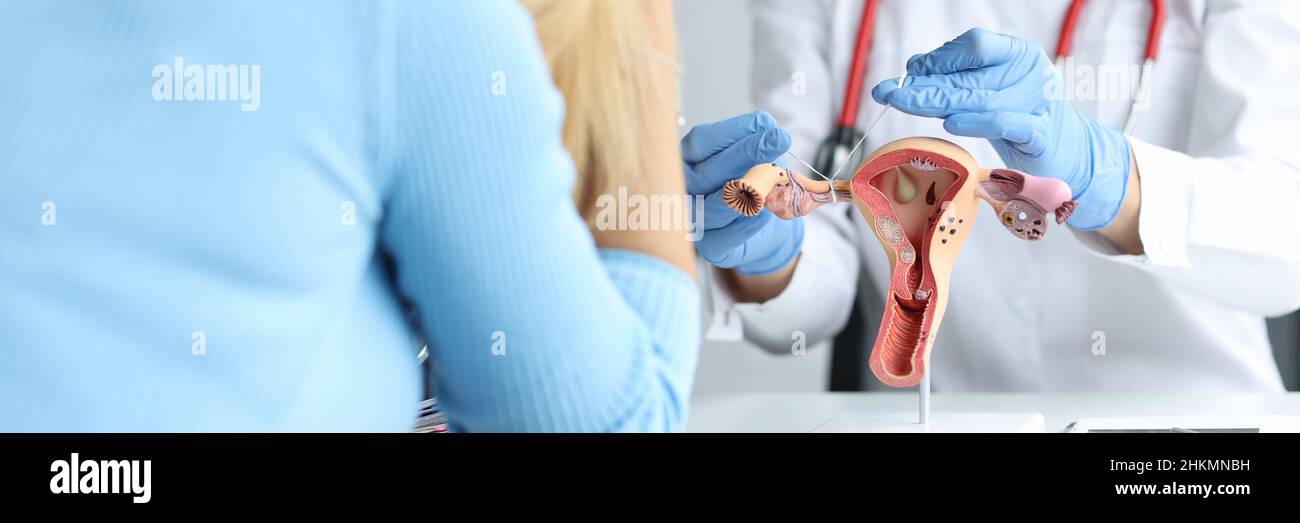 Gynecologist shows ligation of fallopian tubes to patient closeup Stock ...