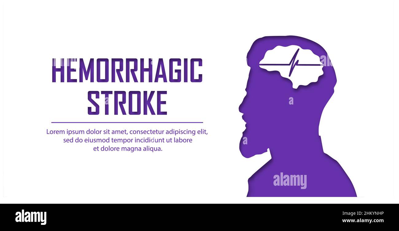 People suffering from hemorrhagic stroke. Hemorrhagic stroke patient ...