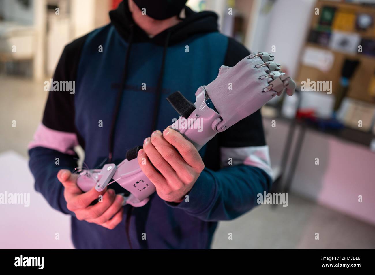 Arm prosthesis hi-res stock photography and images - Alamy