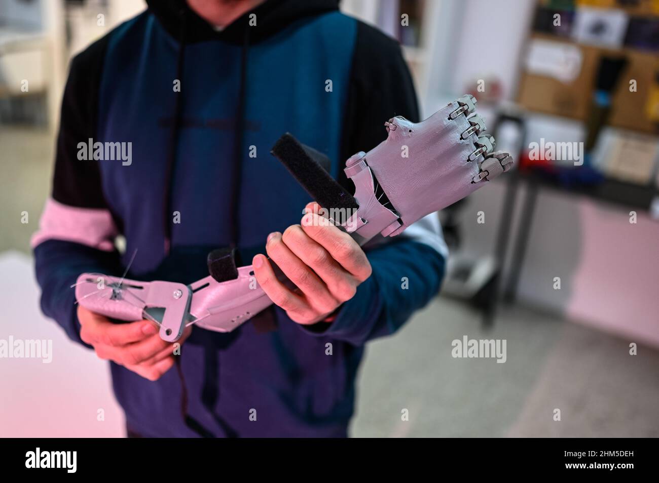 Arm prosthesis hi-res stock photography and images - Alamy