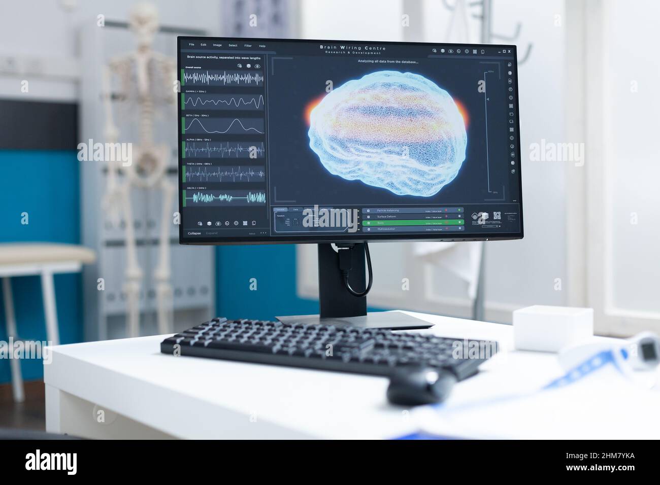 Computer with brain ct scan on screen standing on table in empty ...