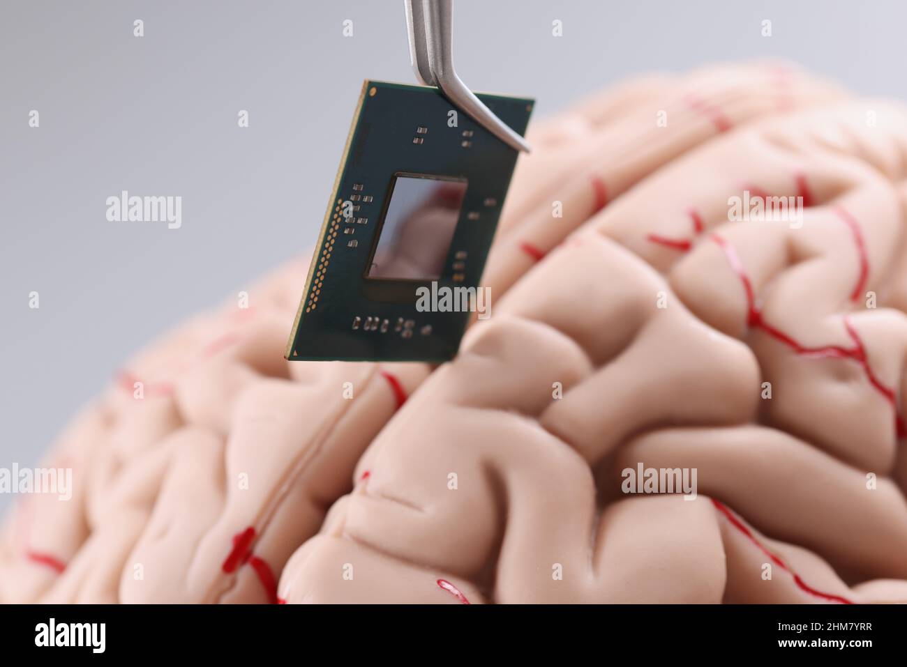 Idea implantation hi-res stock photography and images - Alamy