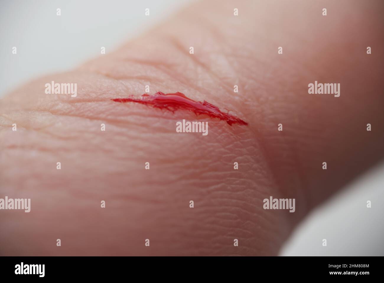 Man with injured finger, bleeding blood on open cut wound Stock Photo ...
