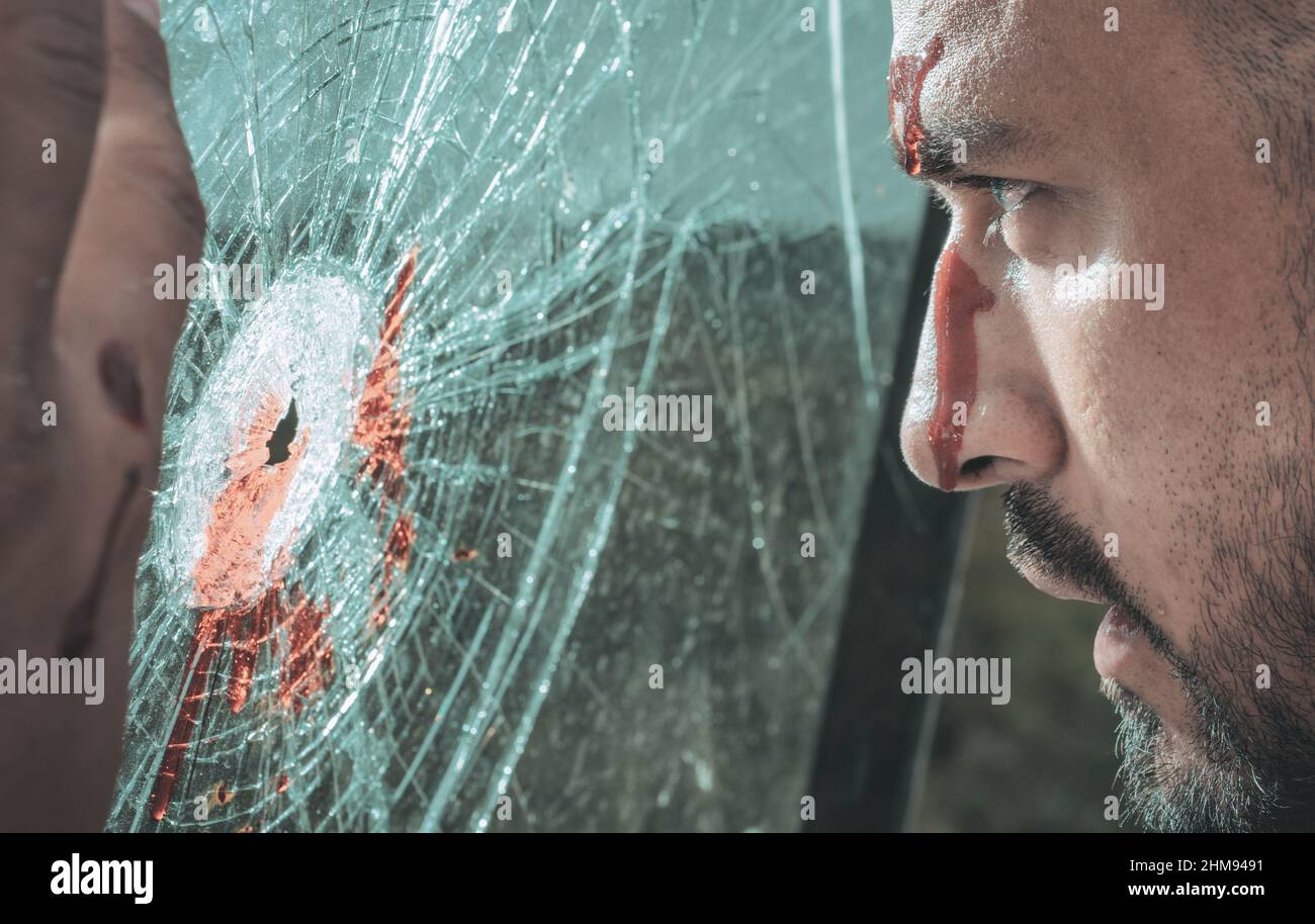 Surviving an injury. Latino man with wound injury looking through ...