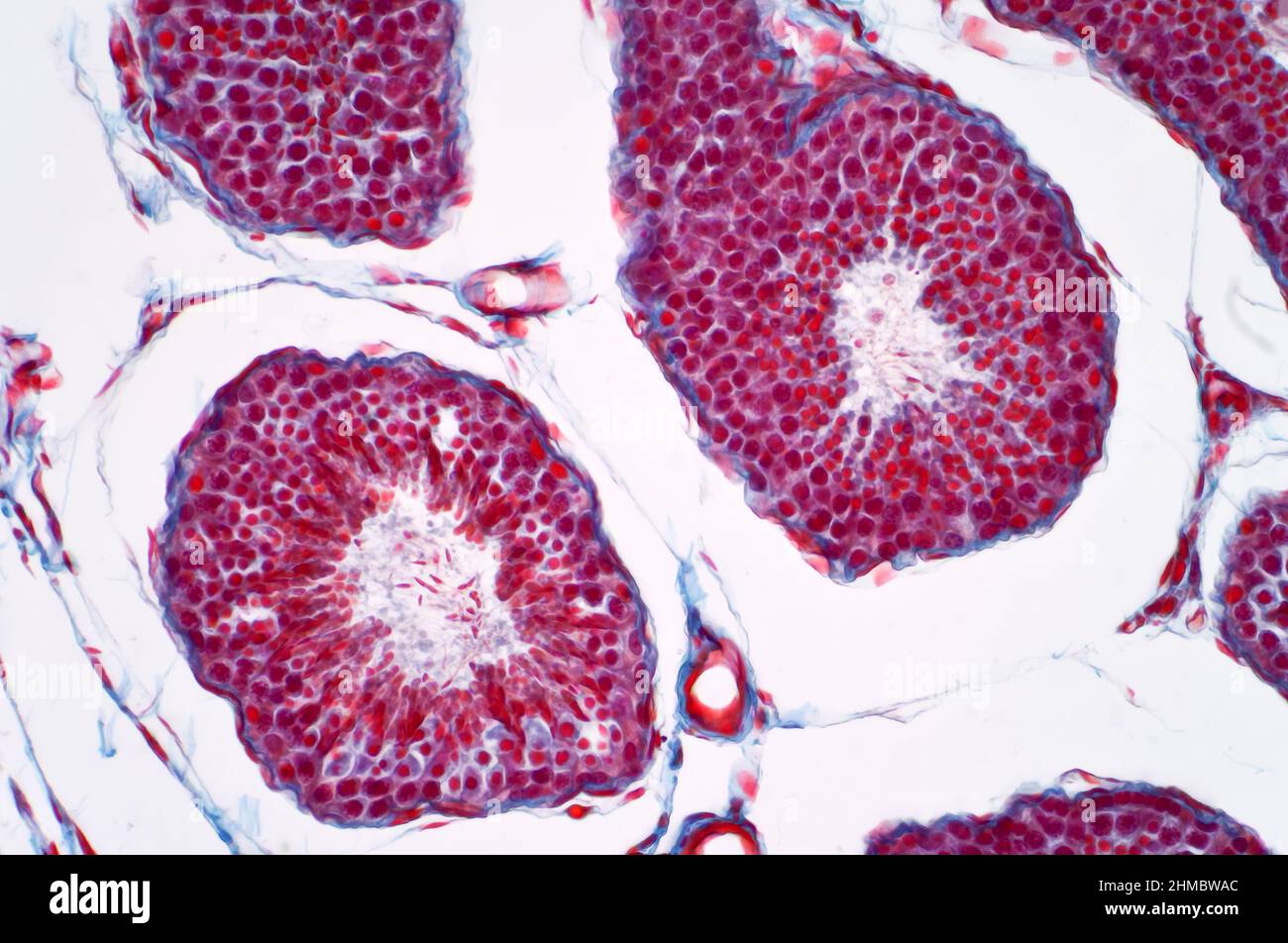 Human testis, light micrograph Stock Photo - Alamy