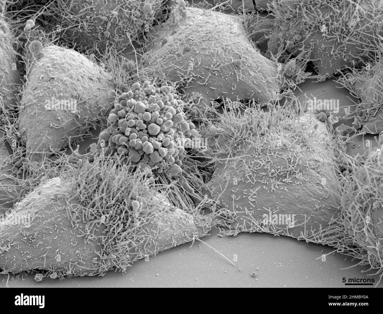 HeLa cells, SEM Stock Photo - Alamy
