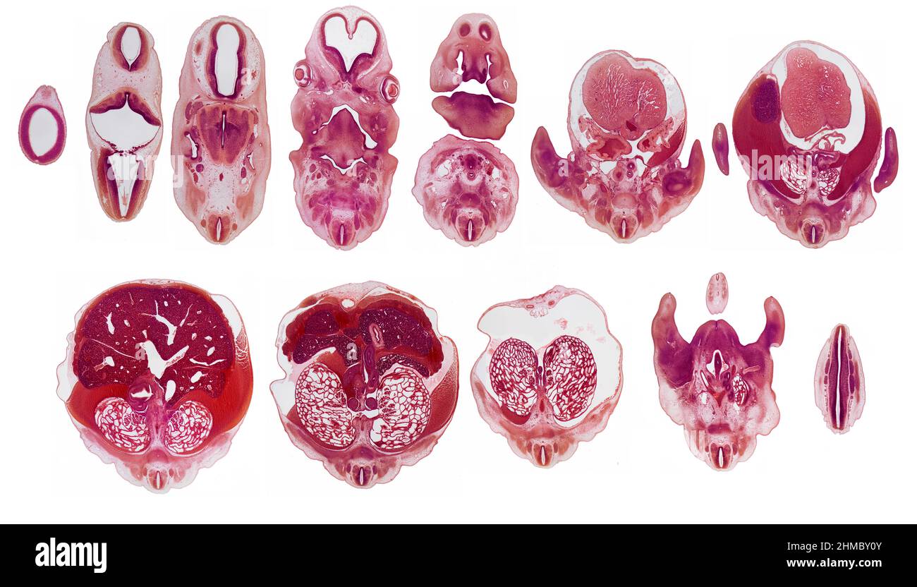 Pig Embryo development, LM Stock Photo - Alamy