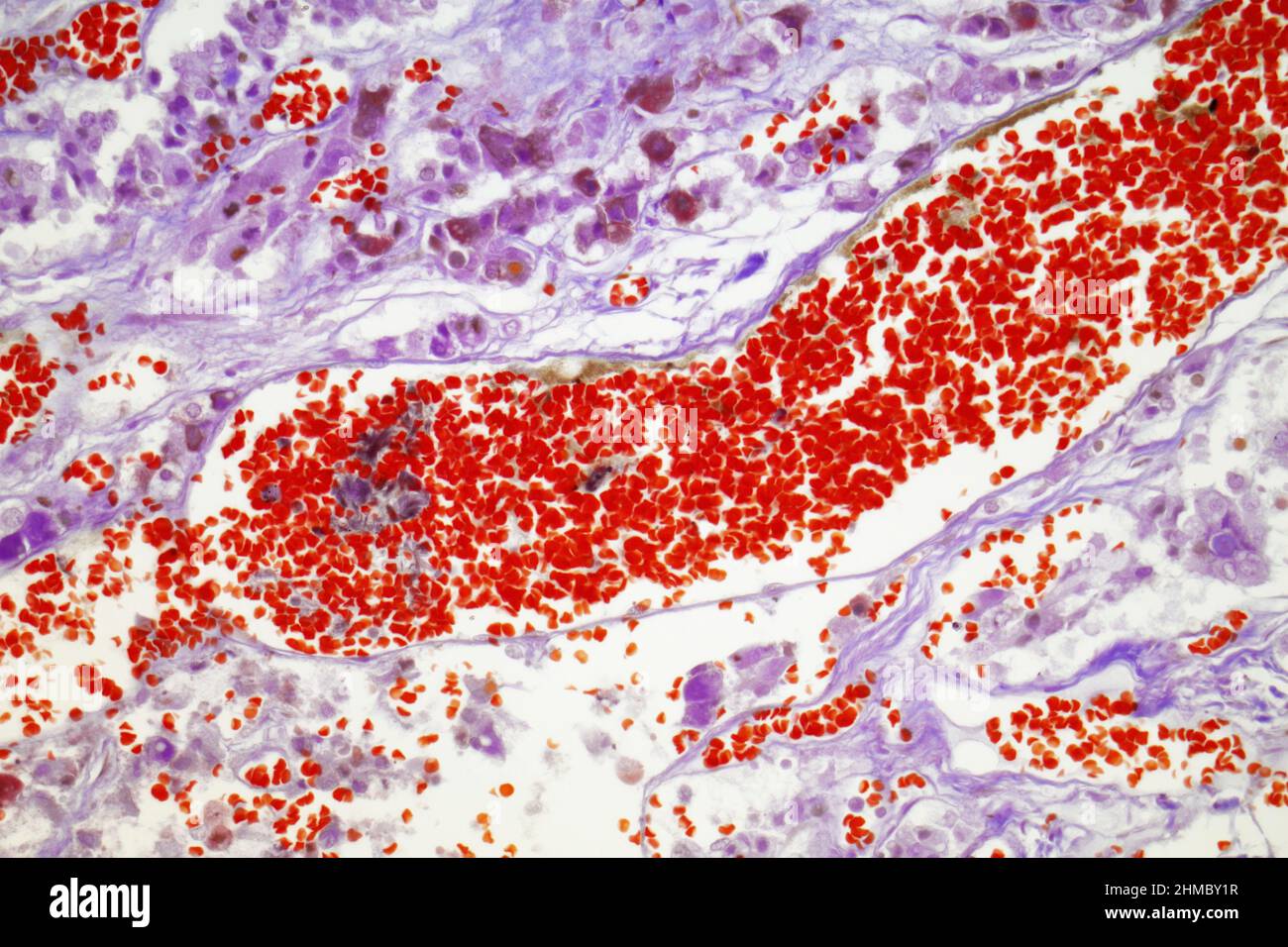 Pituitary blood vessels, LM Stock Photo - Alamy