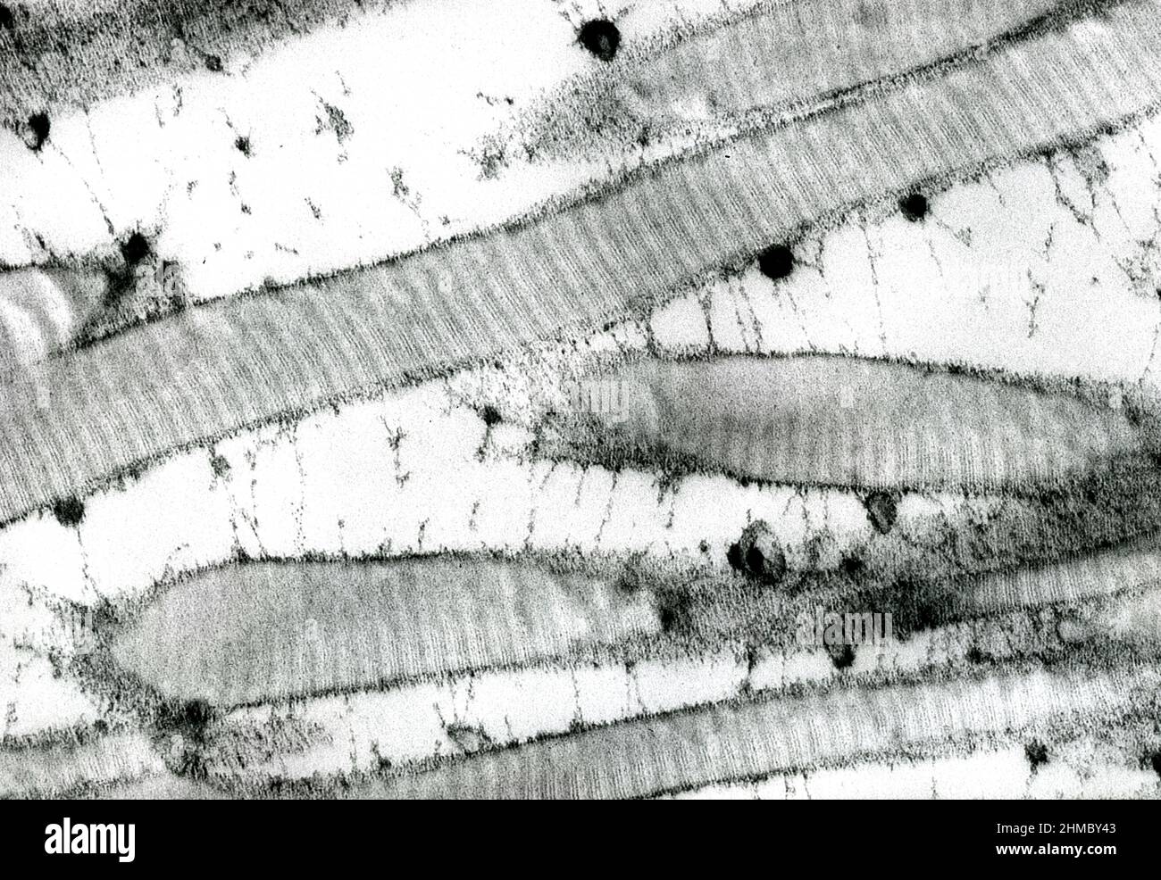 Collagen fibrils, TEM Stock Photo - Alamy