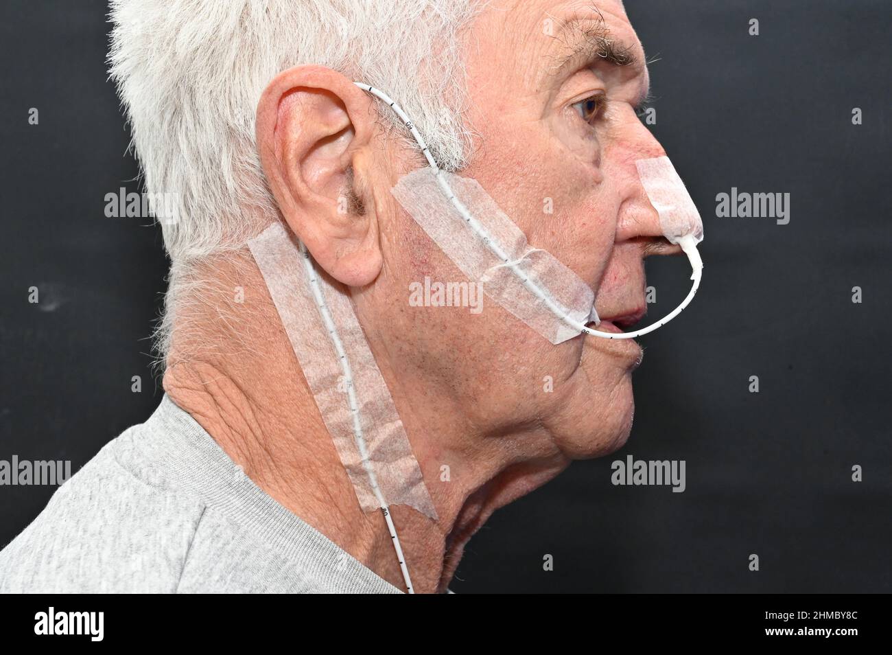 Oesophageal manometry and pH testing Stock Photo - Alamy