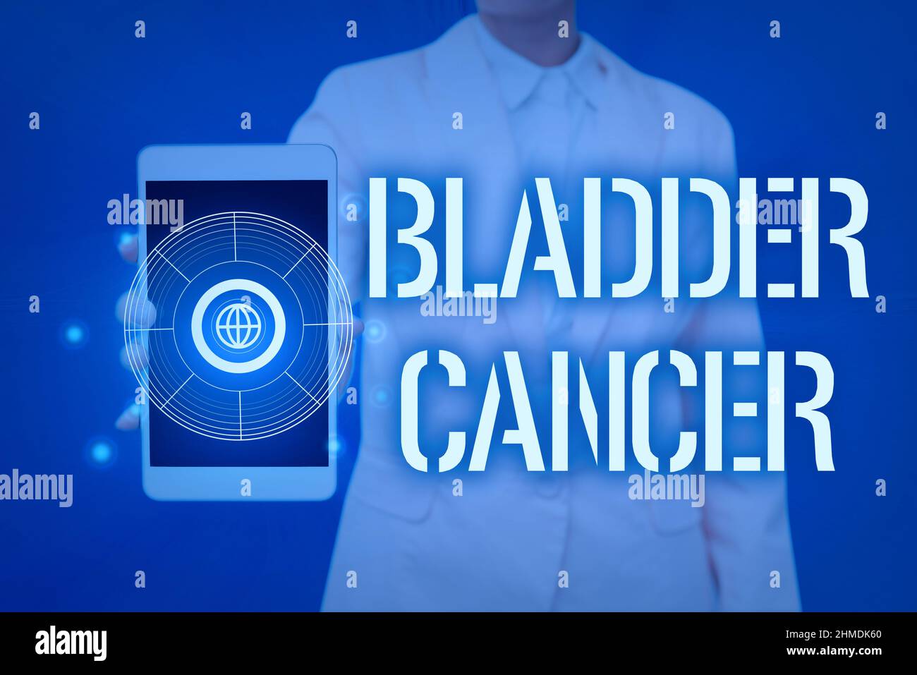 Writing displaying text Bladder Cancer. Internet Concept form of cancer ...