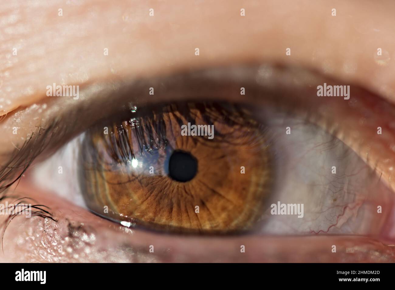 Epidermide hi-res stock photography and images - Alamy