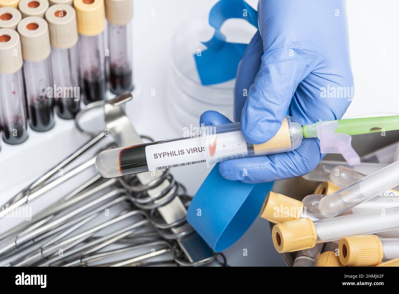 Test tube with blood for Syphilis test in front of researcher Stock ...