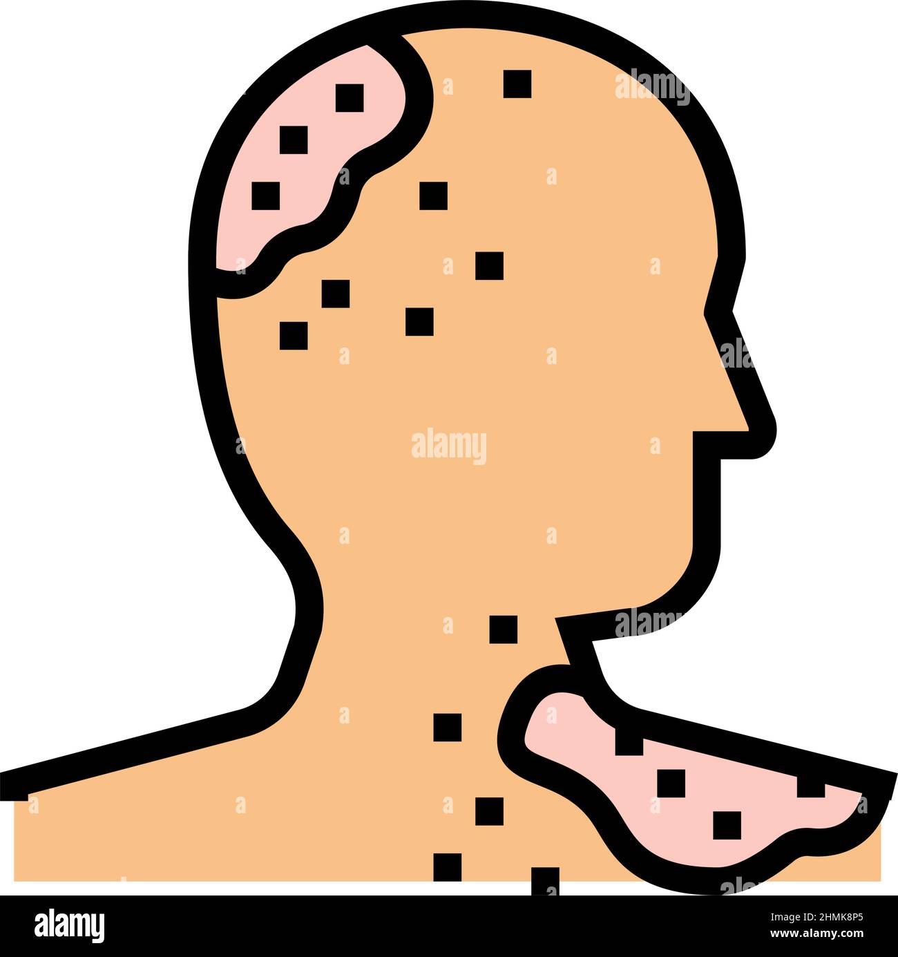 allergy skin color icon vector illustration Stock Vector Image & Art ...