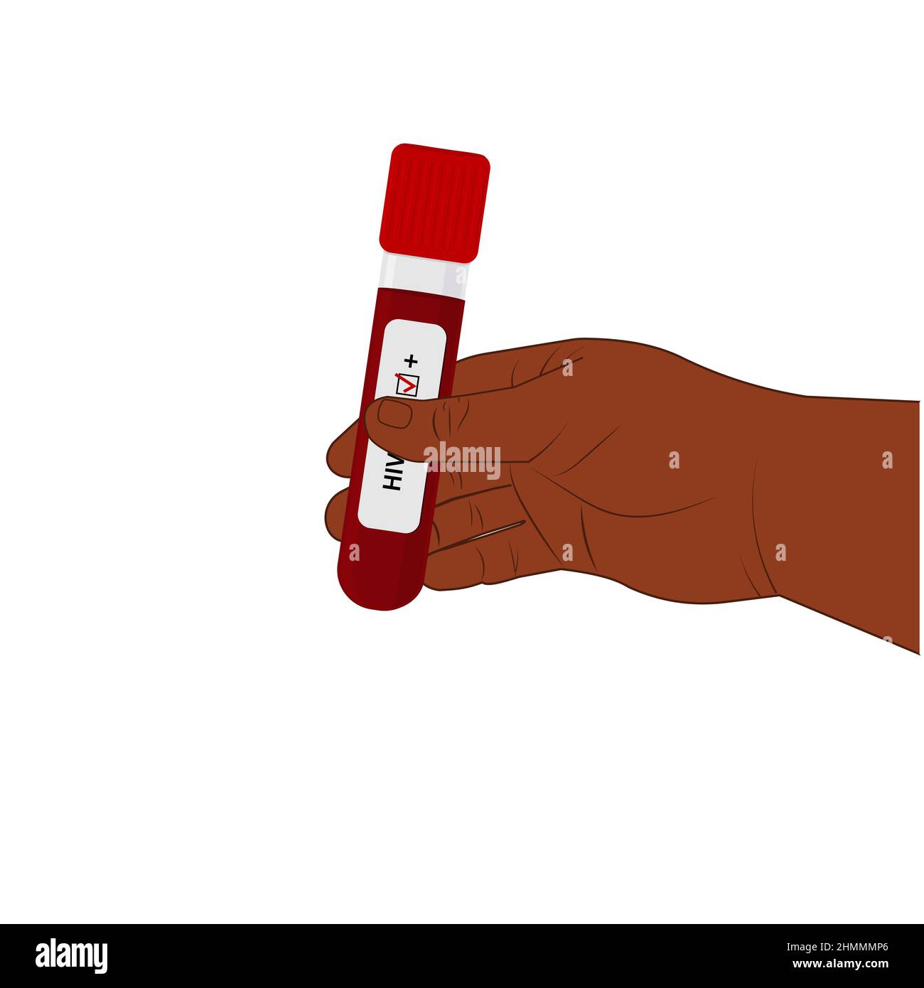 An HIV testing kit with a laboratory test tube for blood analysis ...
