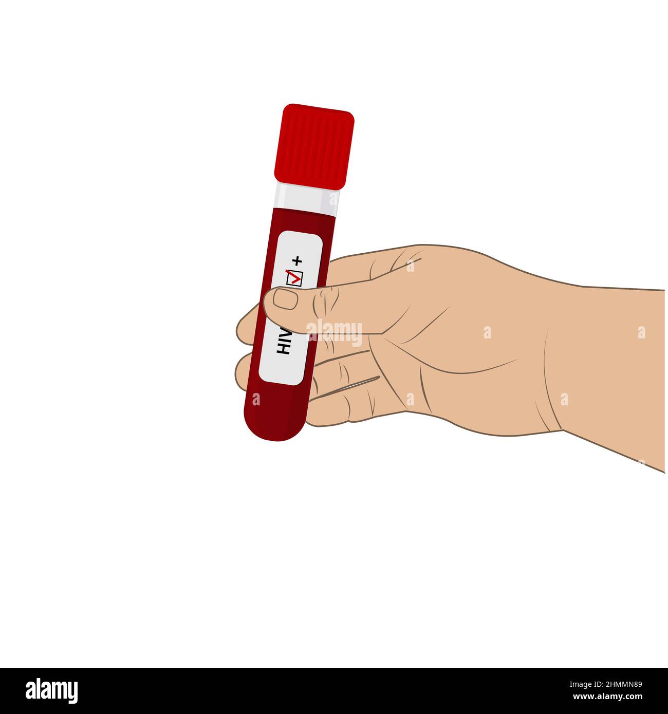 An HIV testing kit with a laboratory test tube for blood analysis ...