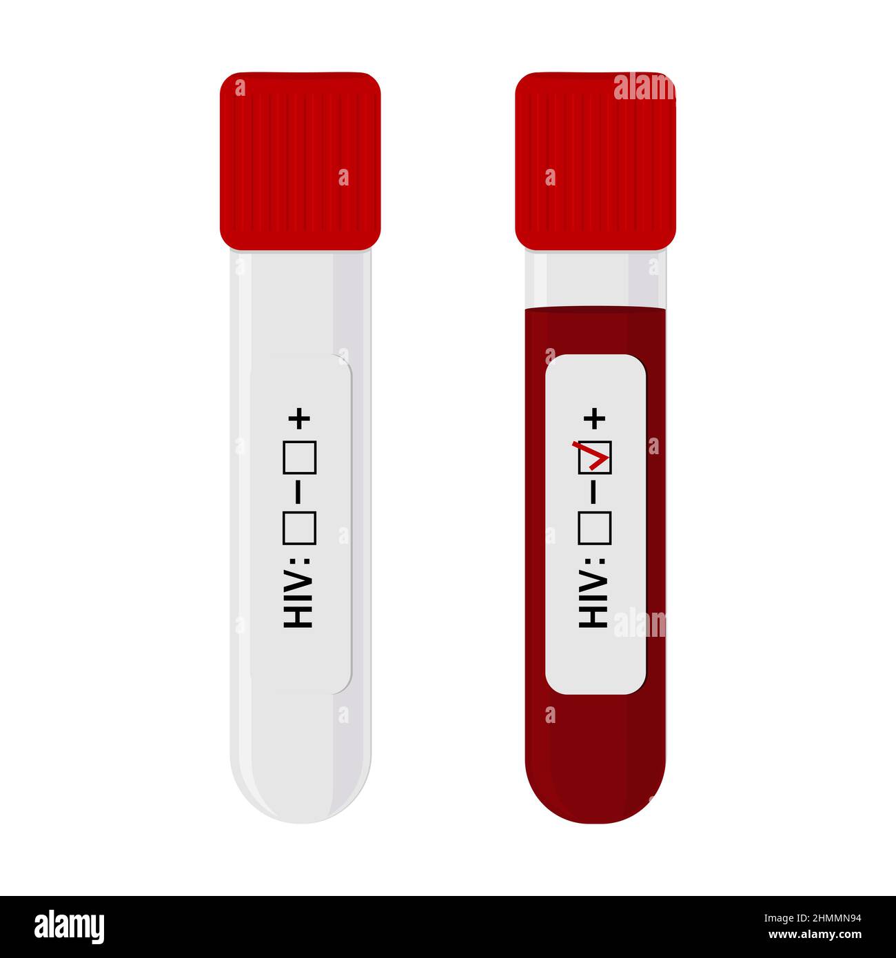 An HIV testing kit with a laboratory test tube for blood analysis ...