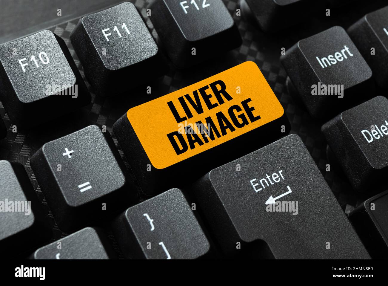Writing displaying text Liver Damage. Business concept any disorder of ...