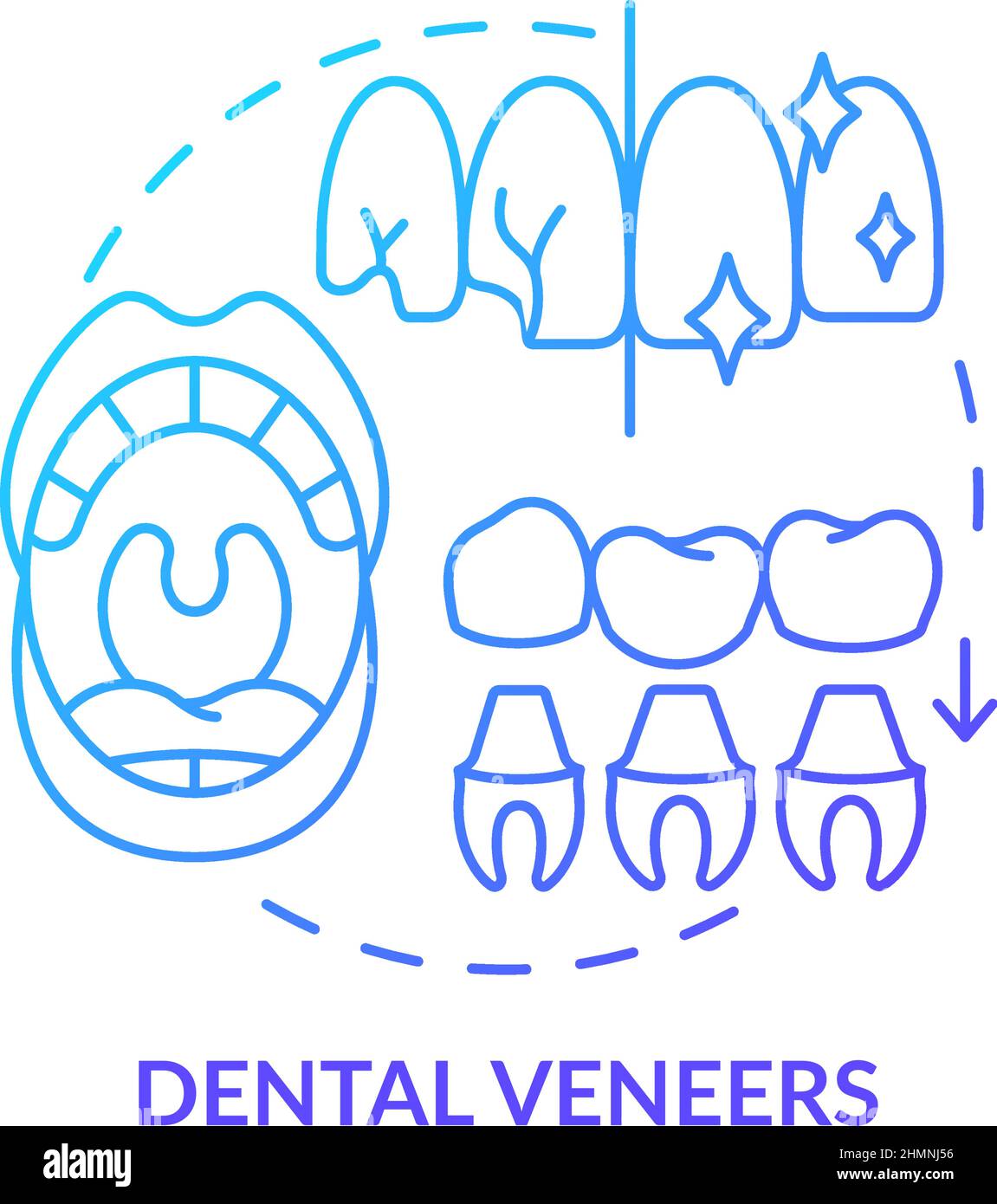 Veneers logo Cut Out Stock Images & Pictures - Alamy
