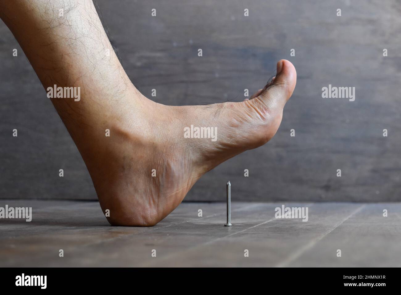 Nail prick injury in foot of Asian young man. Concept of tetanus Stock ...