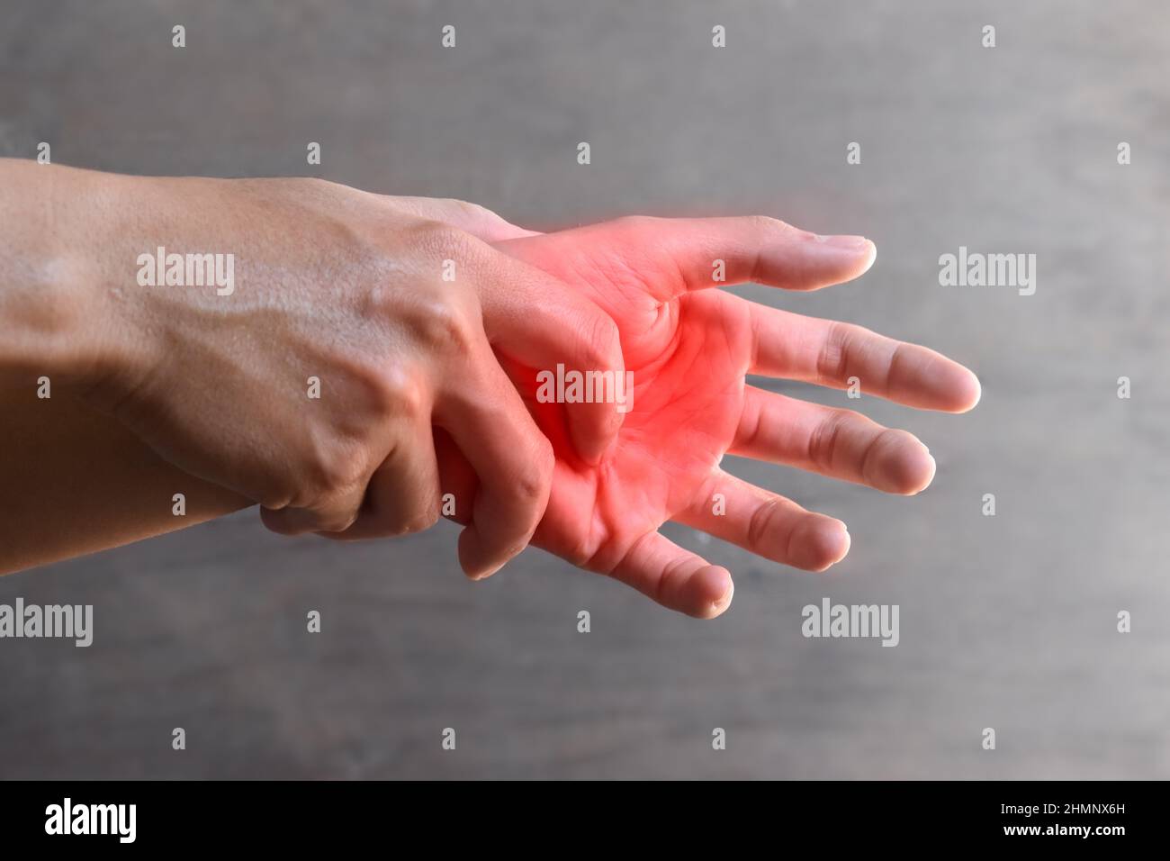 Painful palmar aspect of Asian young man. Concept of compartment ...