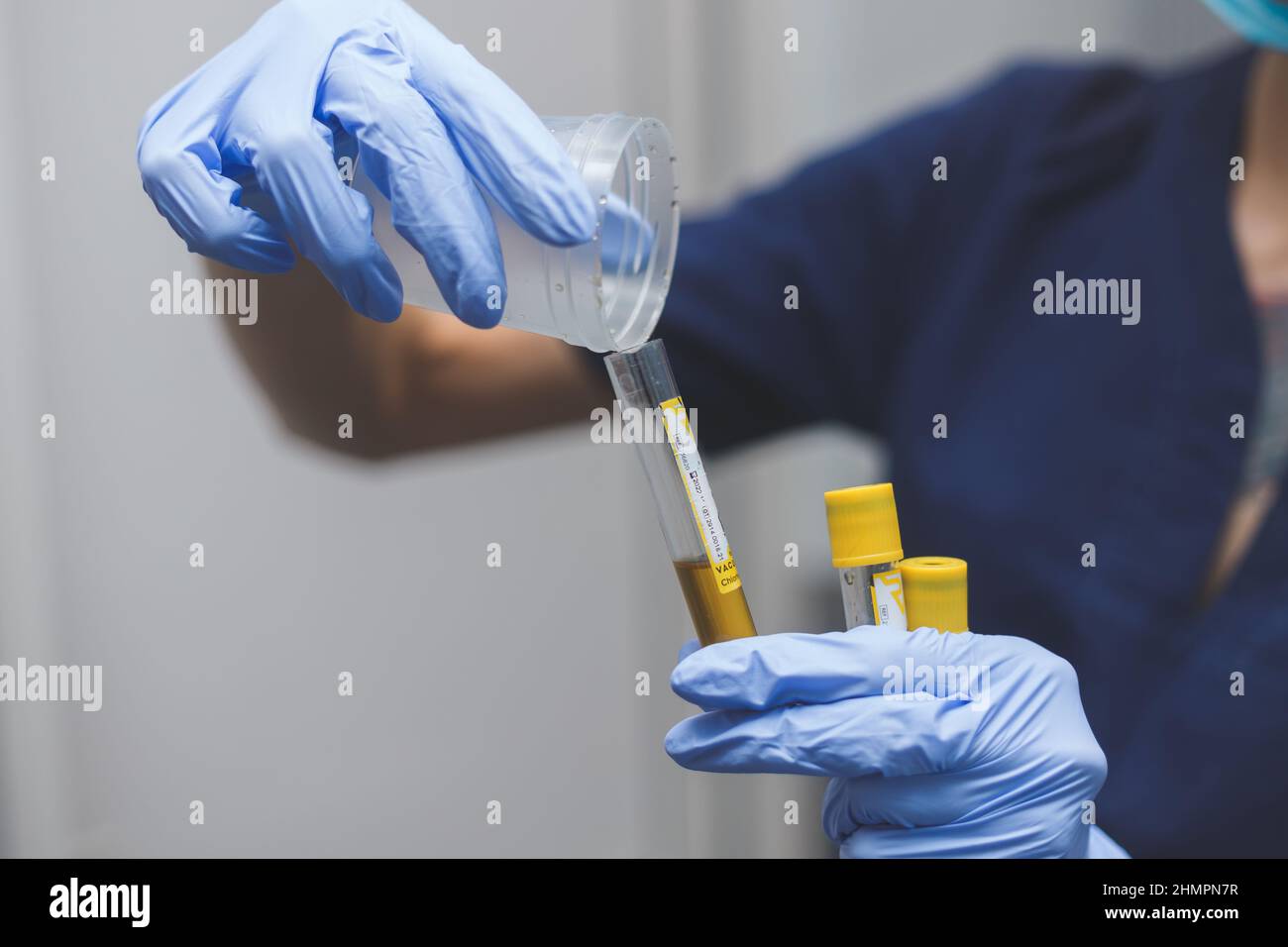 Laboratory assistant pours urine from container into test tube for ...