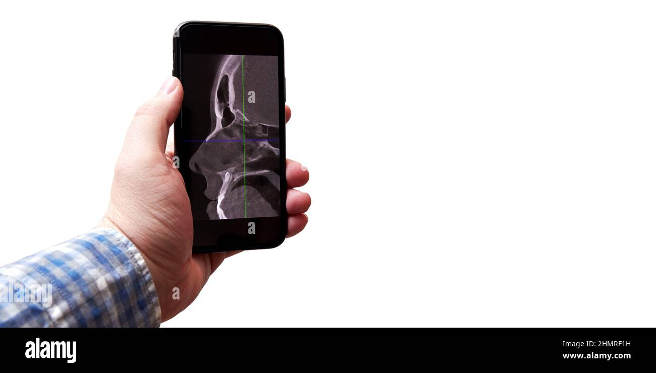 Head CT scan on a cell phone screen in a man's hand with copy space ...