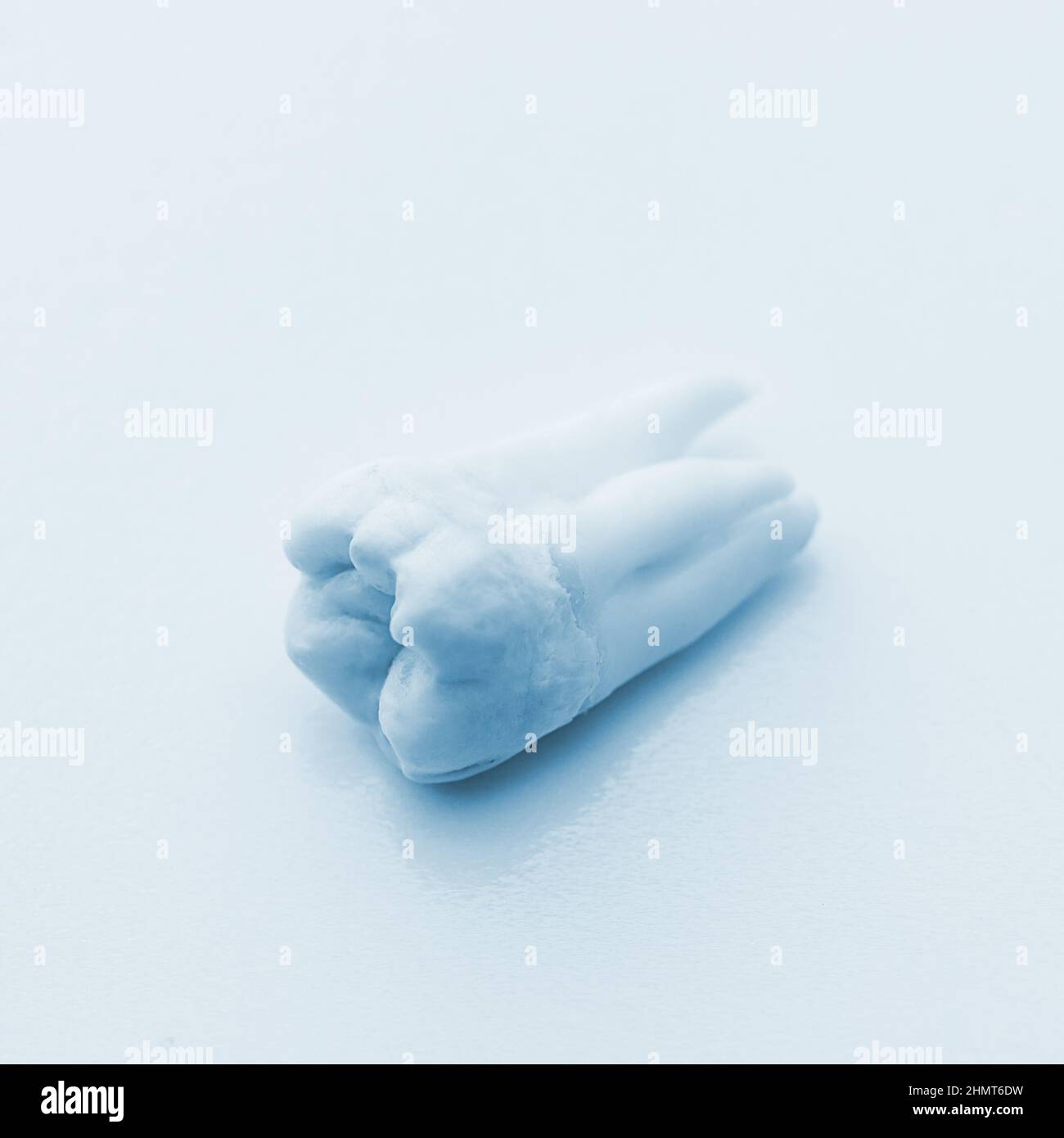 Dental wisdom tooth Stock Photo - Alamy