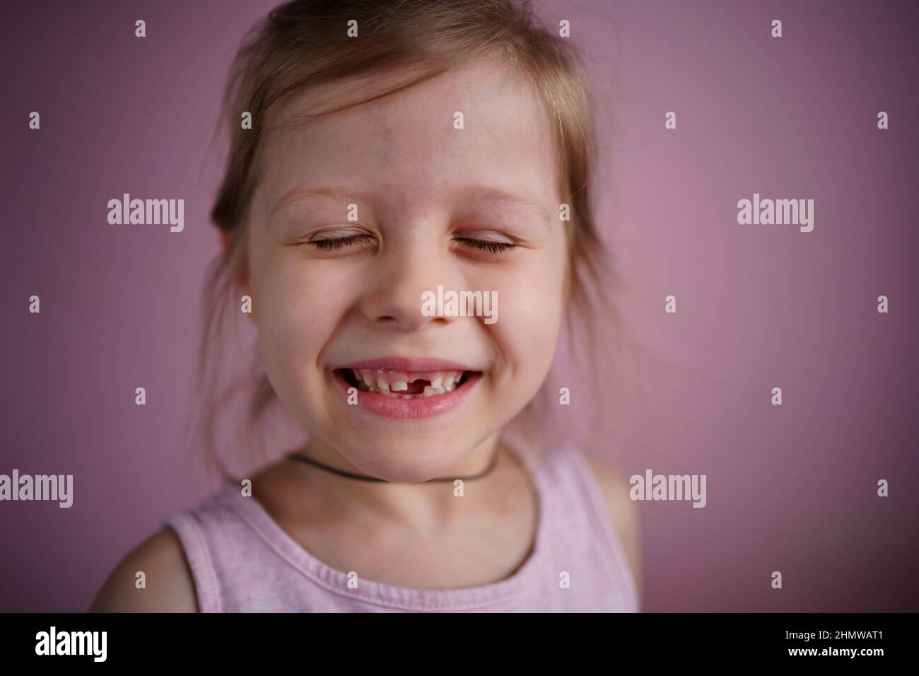 Lost tooth girl portrait hi-res stock photography and images - Alamy