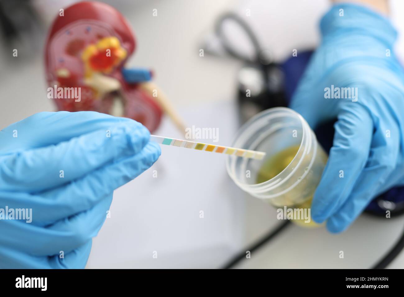 Doctor urologist making express urine test using indicator paper ...
