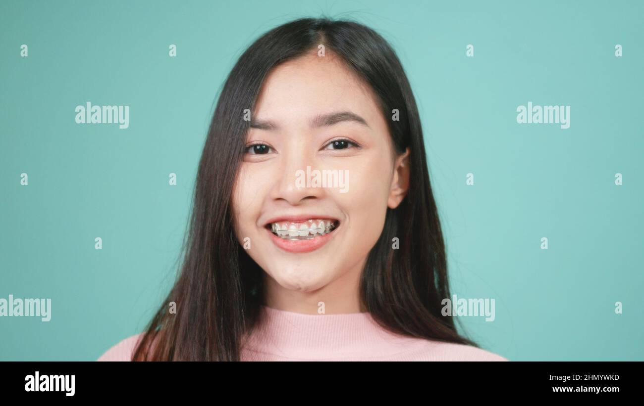 Portrait young Asian beautiful woman smiling wear silicone orthodontic ...