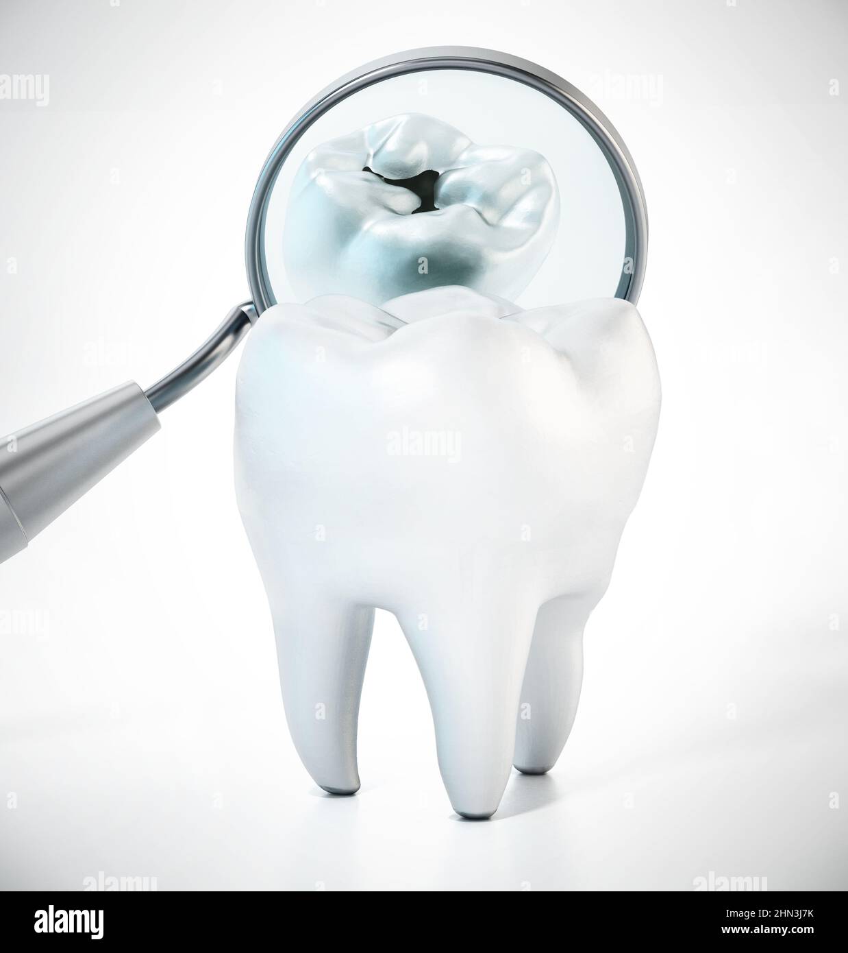 Dentist mirror showing the back of the isolated tooth. 3D illustration ...