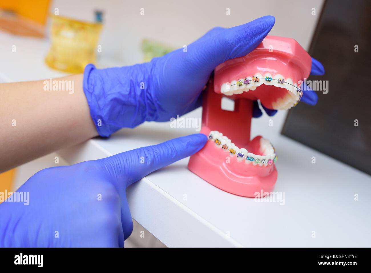 Smile appearance braces teeth hi-res stock photography and images - Alamy