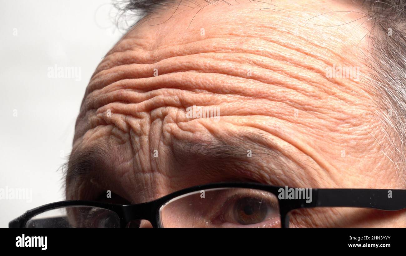 Skin folds on the forehead of an older man Stock Photo - Alamy