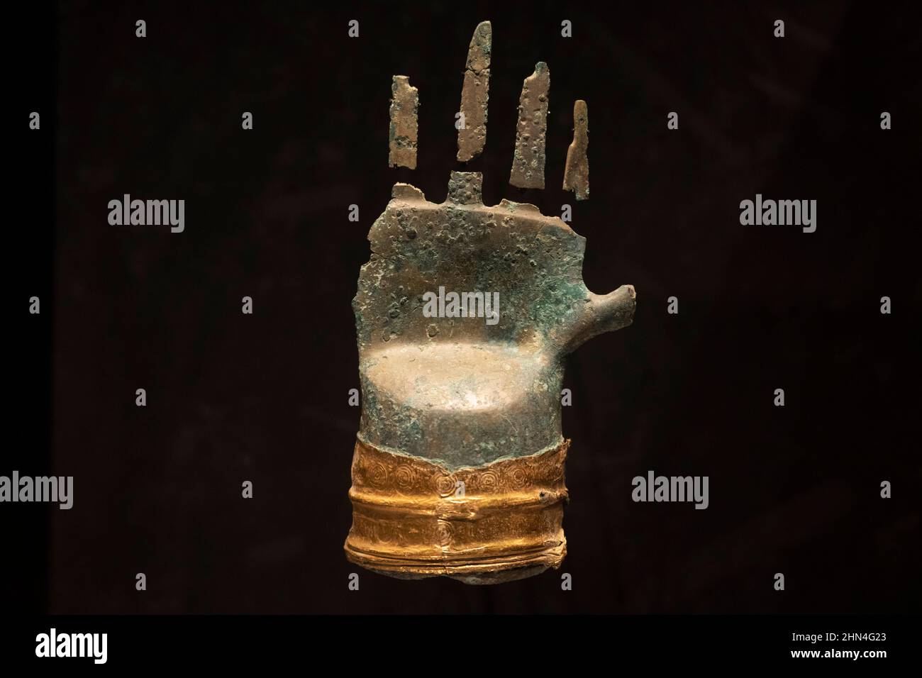 Earliest prosthetic hand for a casualty of conflict hi-res stock ...
