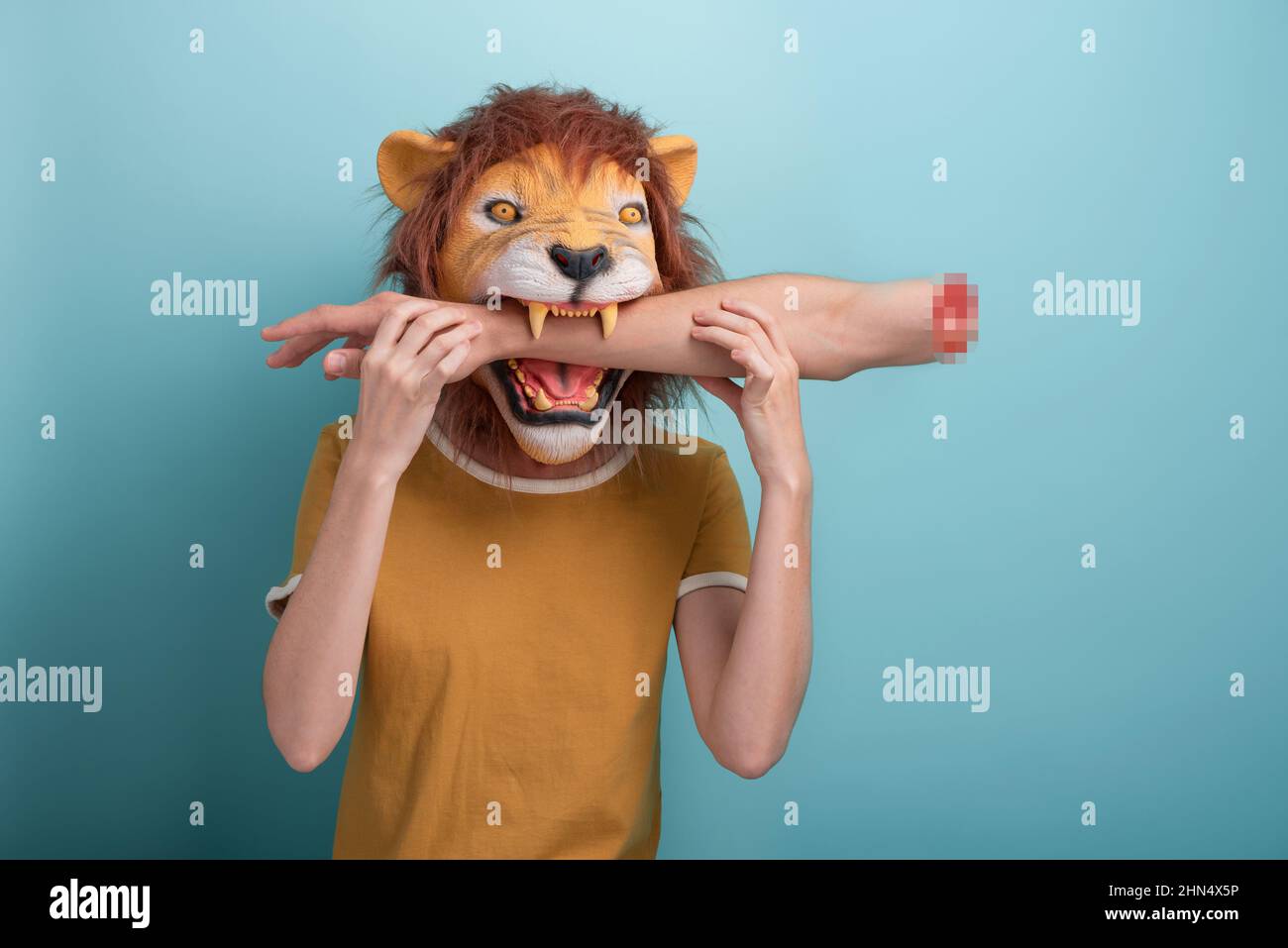 Bitten hand hi-res stock photography and images - Alamy
