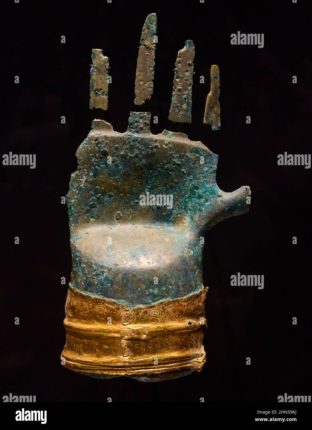 Earliest prosthetic hand for a casualty of conflict hi-res stock ...