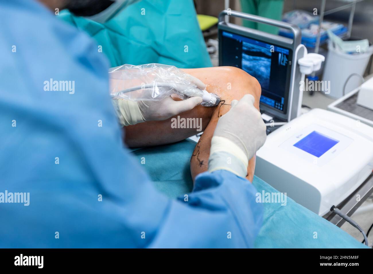 Process of varicose vein surgery in hospital, operating room, vein ...