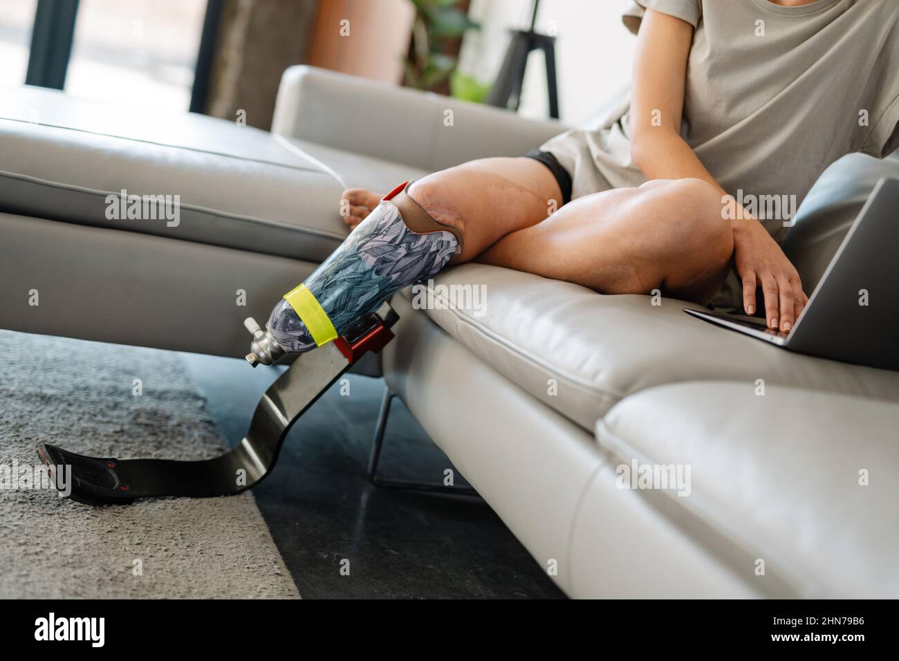 Prostetic leg hi-res stock photography and images - Alamy