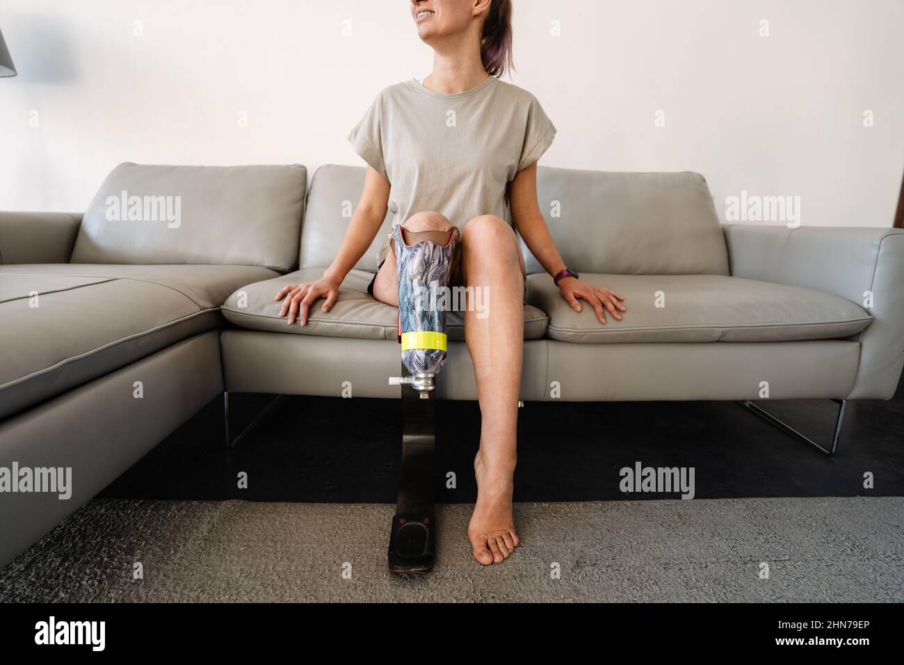 Smiling young white disabled woman with prostetic leg sitting on a ...