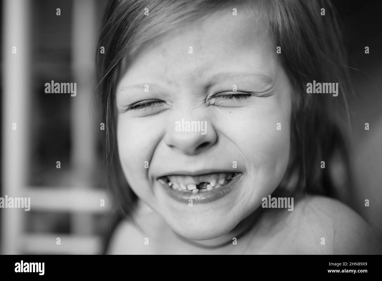 cheerful girl without front teeth Stock Photo - Alamy